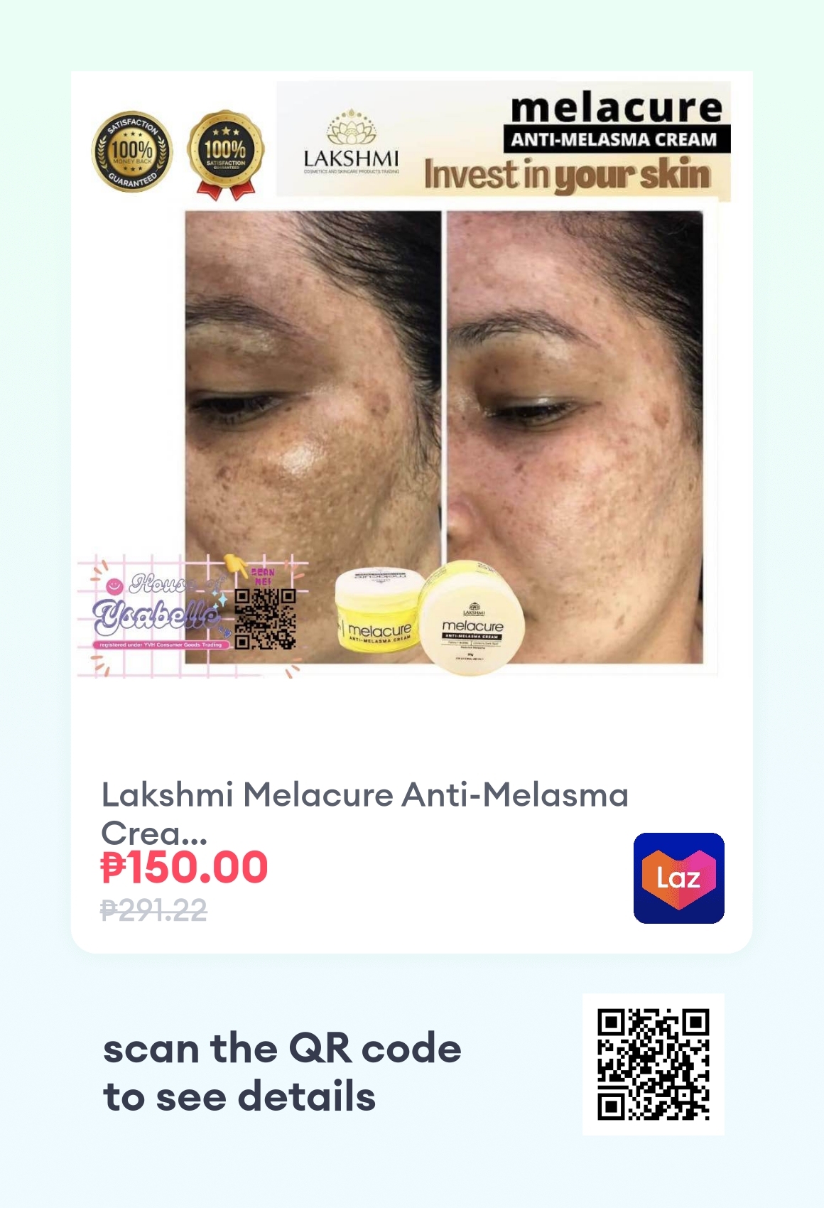 Lakshmi Melacure Anti-Melasma Cream 30g - Pekas Remover, Luminous Skin ...