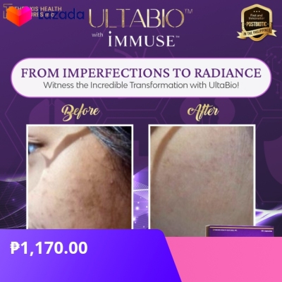 Ultabio with Immuse Lactococcus lactis strain Plasma Postbiotic ...