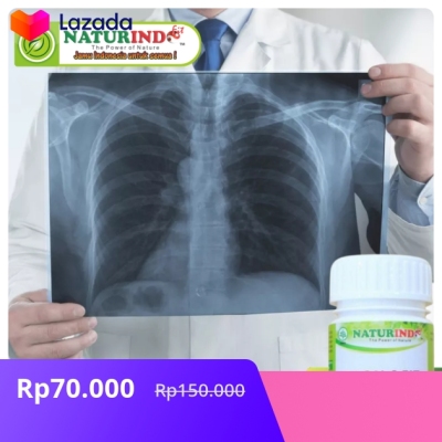 Obat Tbc Paru Paling Ampuh Penyakit Tb Tuberkulosis Batuk Berdarah ...