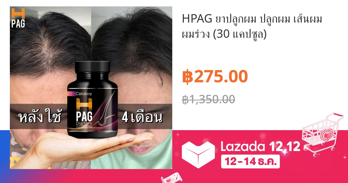 HPAG ยาปลูกผม ปลูกผม เส้นผม ผมร่วง (30 แคปซูล) | Online Shopping Lazada