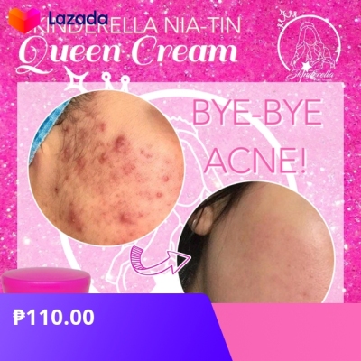 Niatin Cream By Skinderella, 20 grams, Niacinamide Alpha Arbutin Cream ...